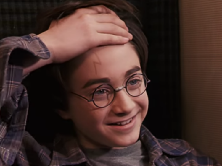 There Is A Very Itchy Reason That Harry Potter Had To Abruptly Stop Filming